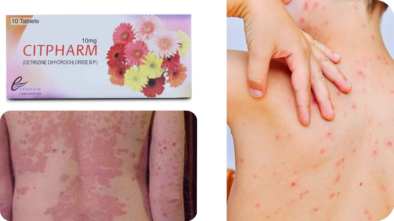 Citpharm 10mg tablet uses in urdu/citpharm tablet used for allergies ...