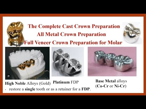 Indications & Contraindications of Complete Cast Crown Preparation ...
