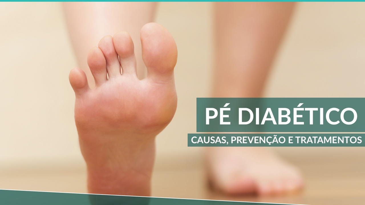 Pé diabético, causas, prevenção e tratamentos | Sua Saúde na Rede - YouTube