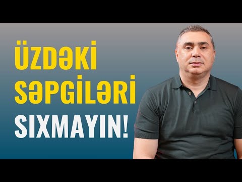 SƏPGİLƏRƏ QƏTİ ƏL VURMAYIN YOXSA... |  Şövqü Salahov