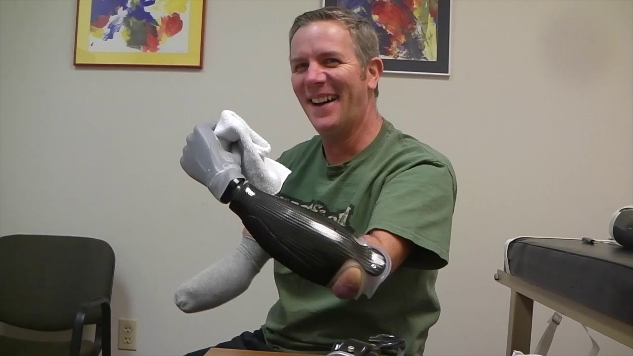 Gerry Gets Acquainted with His New Prosthetic Hands - YouTube