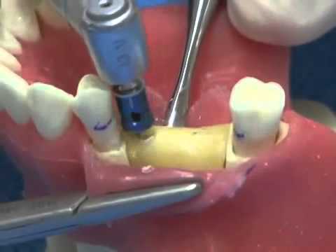 CAS KIT Hands onDr Cho yong seck - YouTube