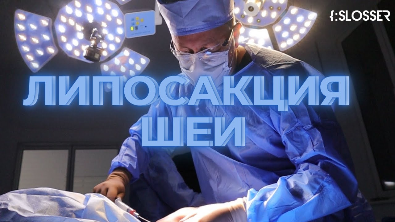 Dr. Slosser Липосакция шеи - YouTube