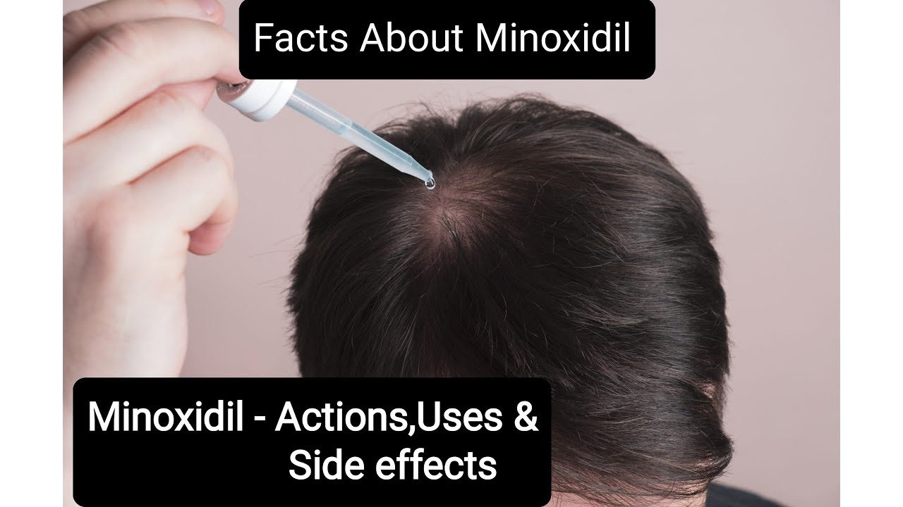Minoxidil - Mechanism,Uses & Side Effects (10 Facts About Minoxidil ...