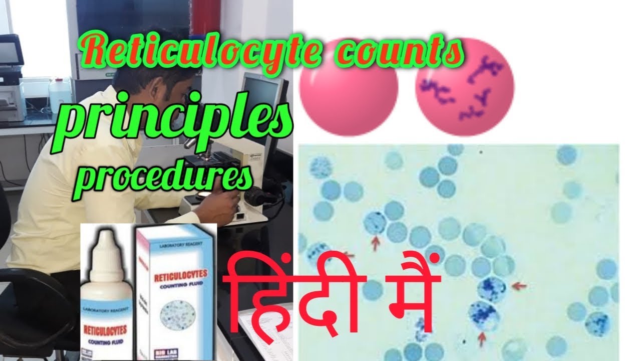 Reticulocyte count |principle|procedure|simple explain in हिंदी|R D ...