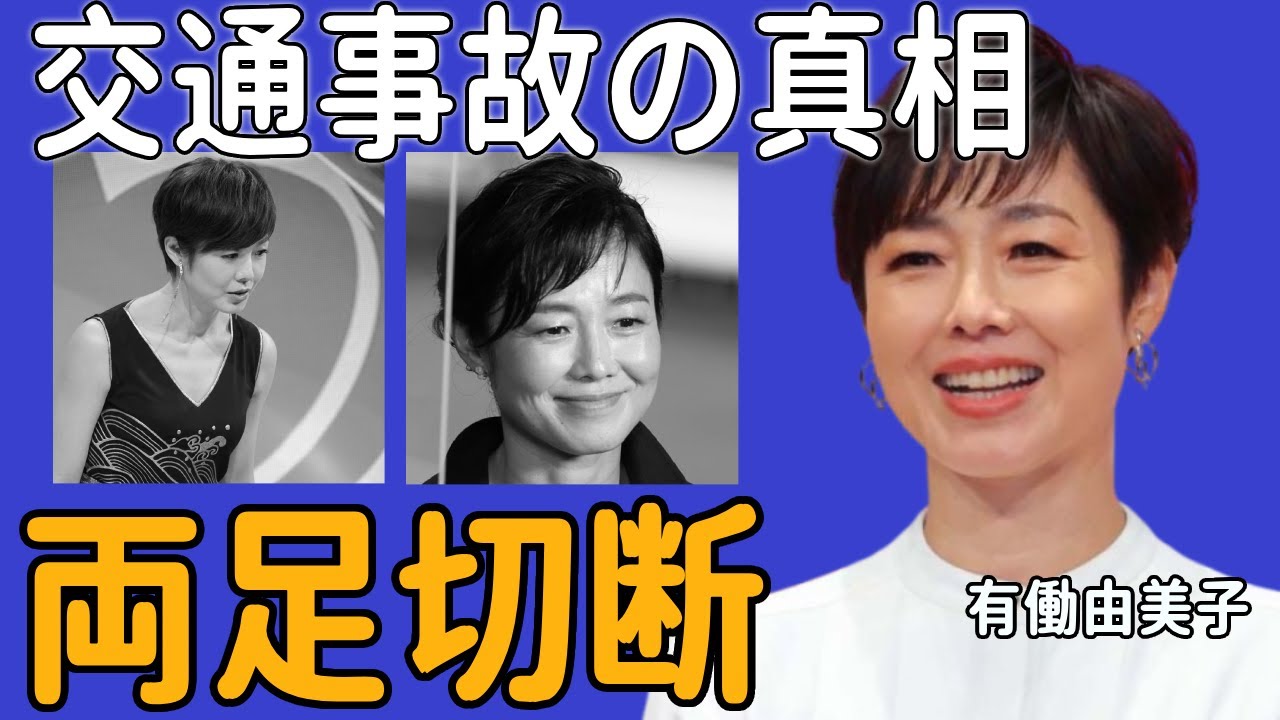 有働由美子が交通事故の真相緊急搬送され両足切断した真相に一同絶句恐怖でお漏らしした姿がテレビに流出して「有働times」の司会者が三谷幸喜にブチギレられた事件に驚きを隠せない