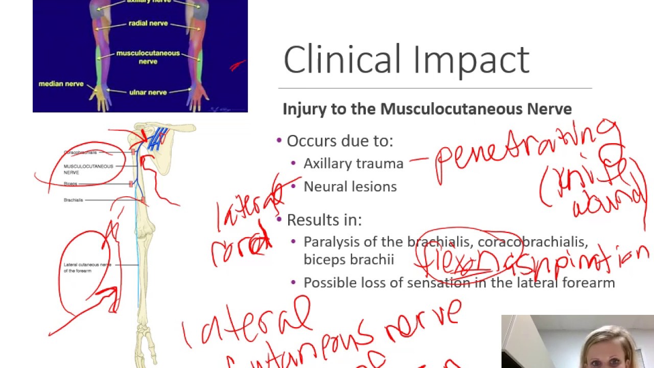 Clinical Anatomy for PA Students: The Upper Extremity II - YouTube