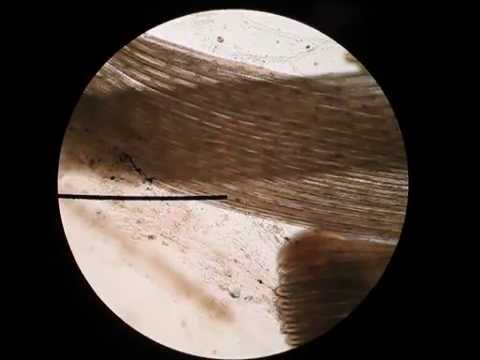 Cilia-Induced Current in Mussel Gill Section Under Light Microscope ...