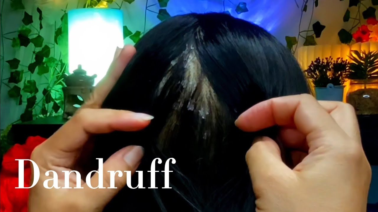 Asmr Satisfying Dandruff Removal Sleep Recovery Super Tingly No