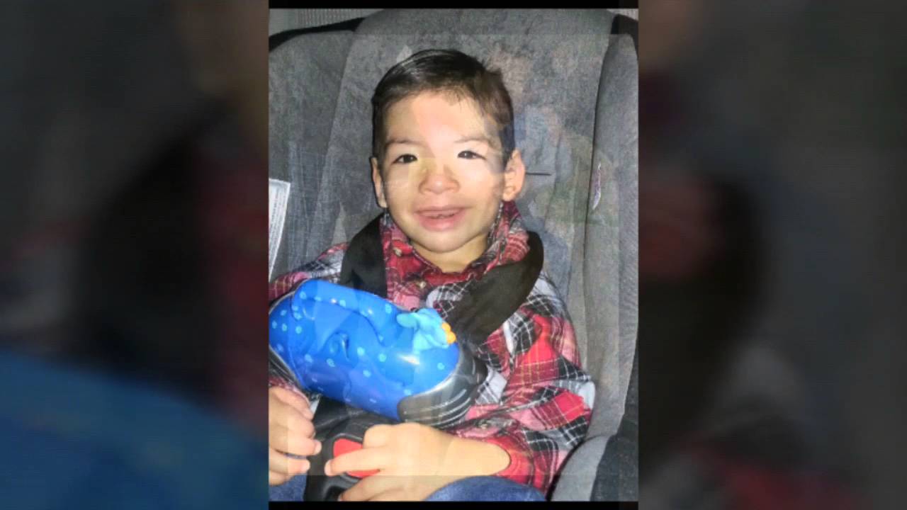 Living with Cri Du Chat - YouTube