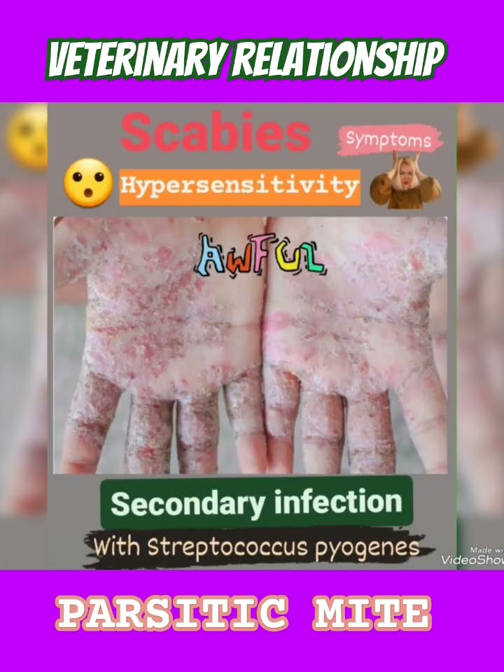 Sarcoptes Scabieiitch Mitescabies Mite👍🔬veterinary Parasitology👍🙏🌹 Youtube