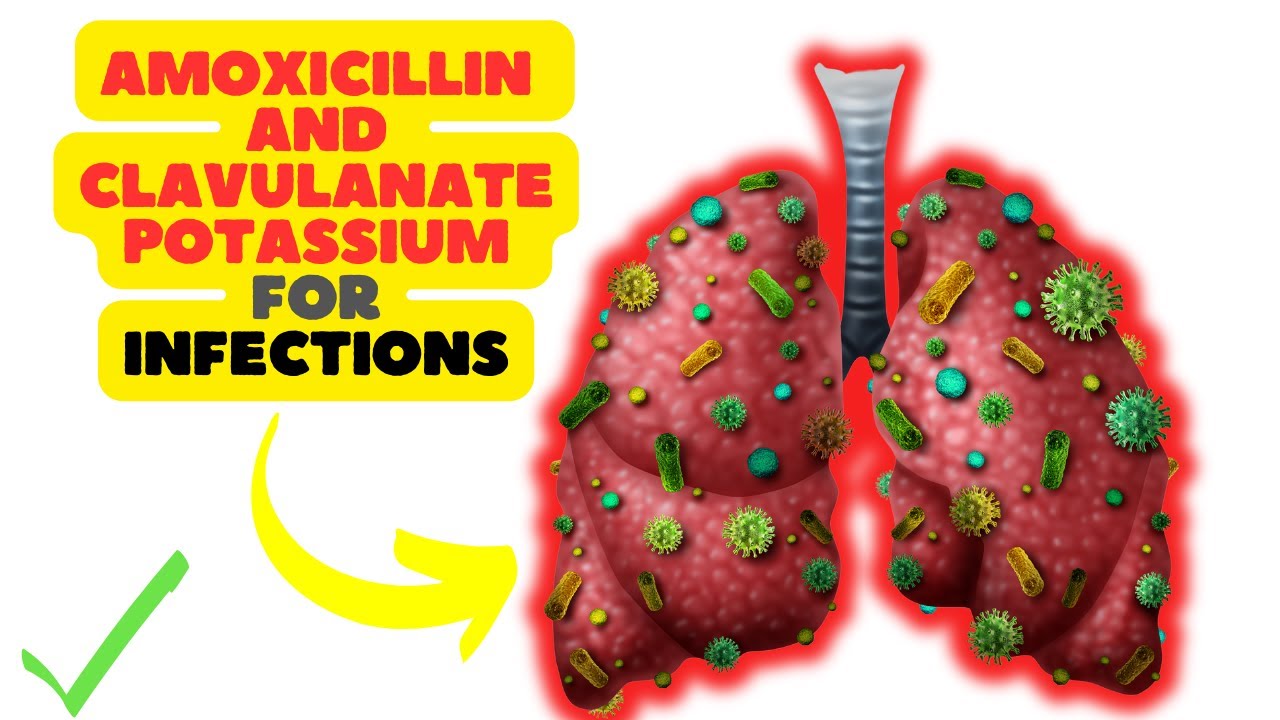Amoxicillin and Clavulanate Potassium: A Dual-Action Antibiotic for ...
