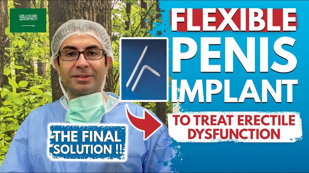 Flexible Penis Implant to treat Erectile Dysfunction, The Final ...