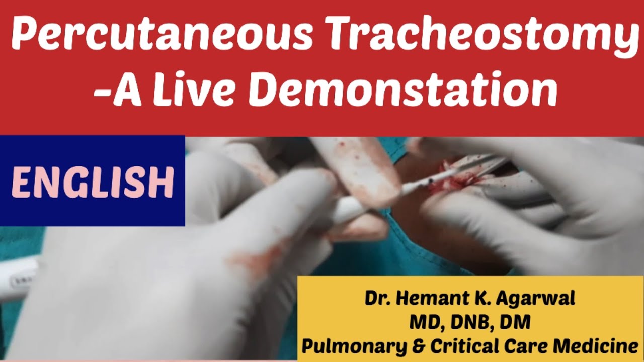 Percutaneous Tracheostomy (ENGLISH)- A Live Demonstration on Patient ...