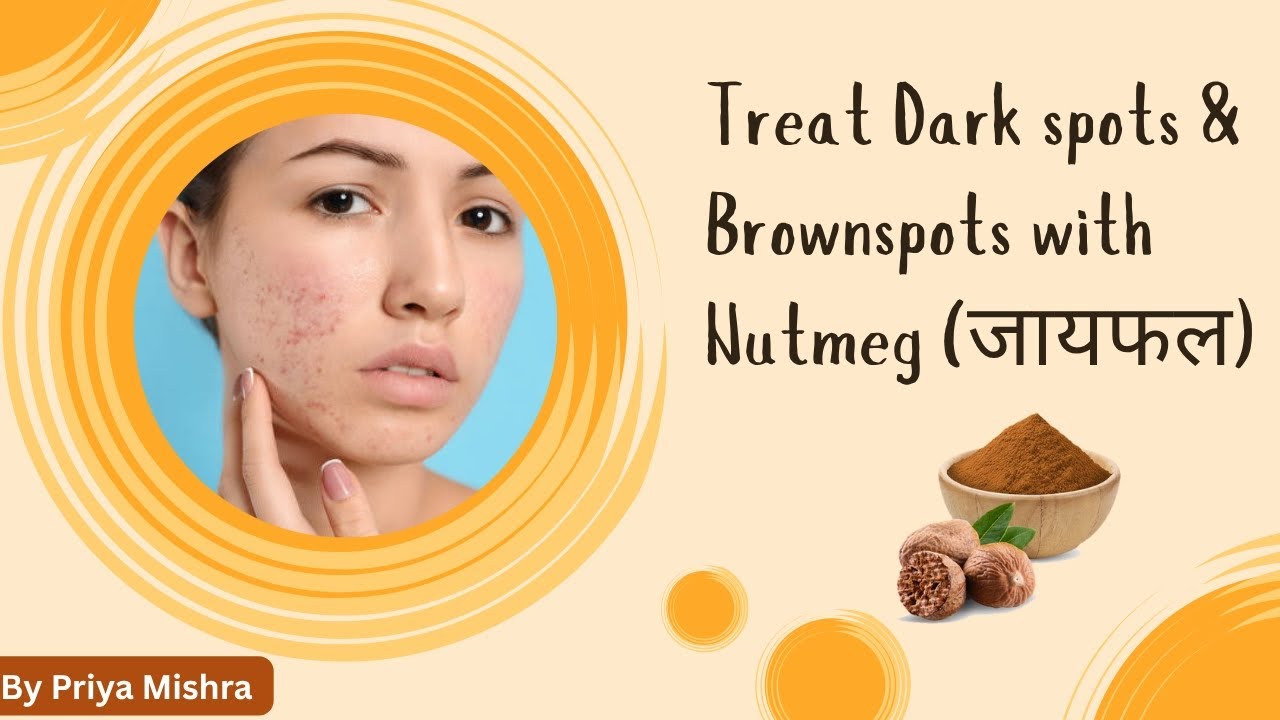Reduce dark spot and brown spots with Nutmeg Facial Pack || Healthy ...