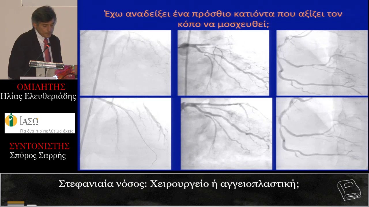 Στεφανιαία Νόσος : χειρουργείο ή αγγειπλαστική - Ηλίας Ελευθεριάδης ...