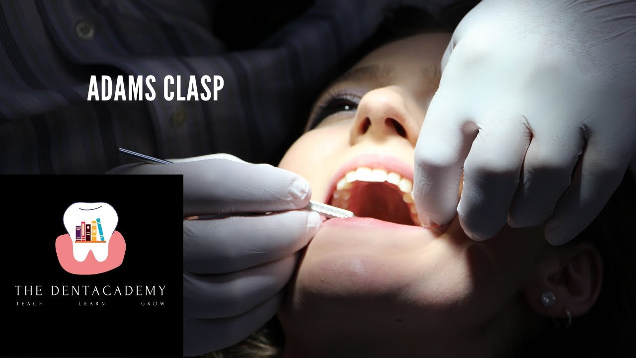 adams clasp - YouTube
