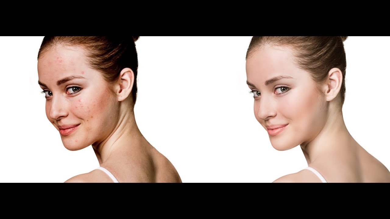 Smooth Skin and Remove Blemishes & Scars easy/smooth skin and remove ...