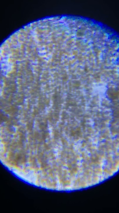 probiotic yogurt under a microscope - YouTube