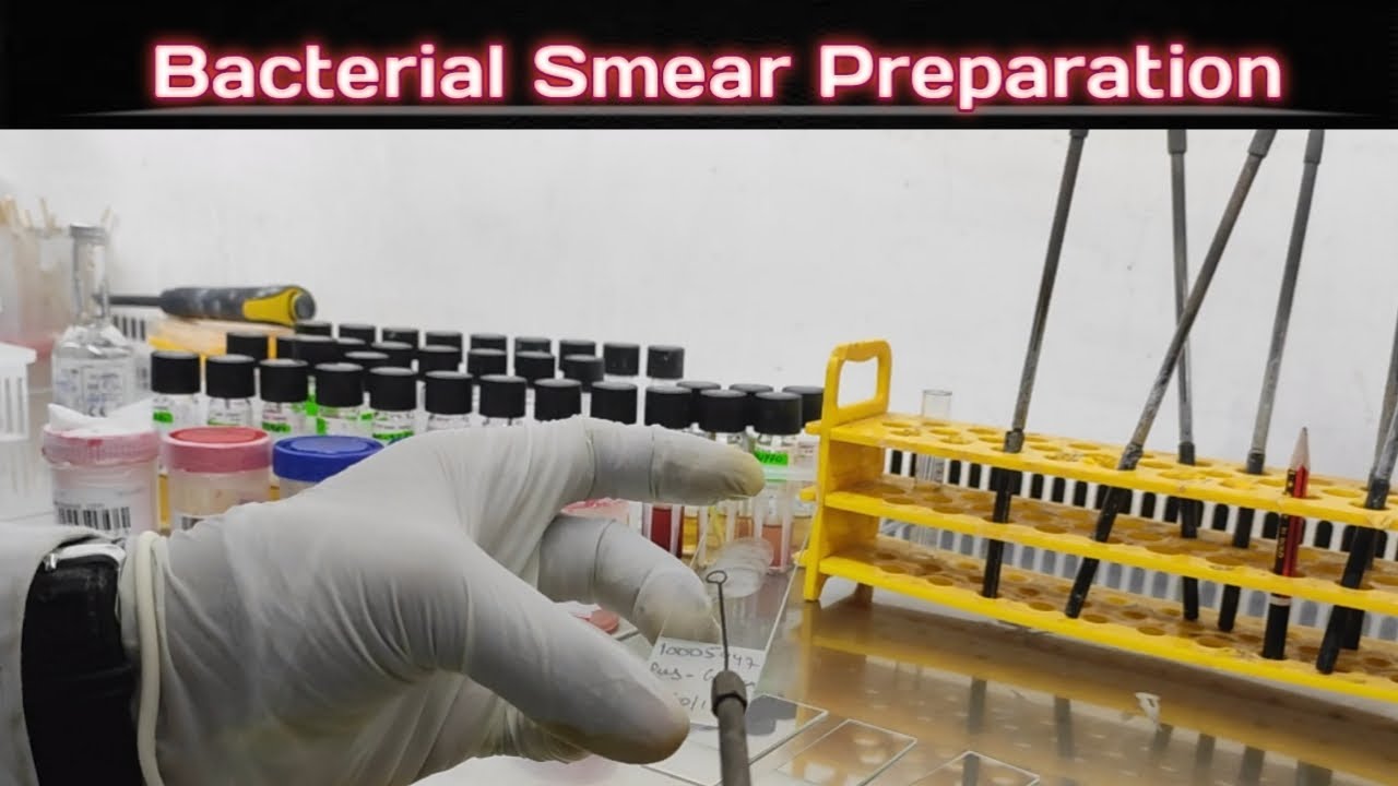 How to make smear | How to make Bacterial Smear | Bacterial smear ...