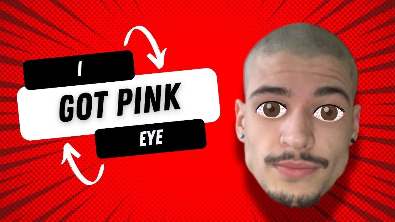 I GOT PINK EYE - YouTube
