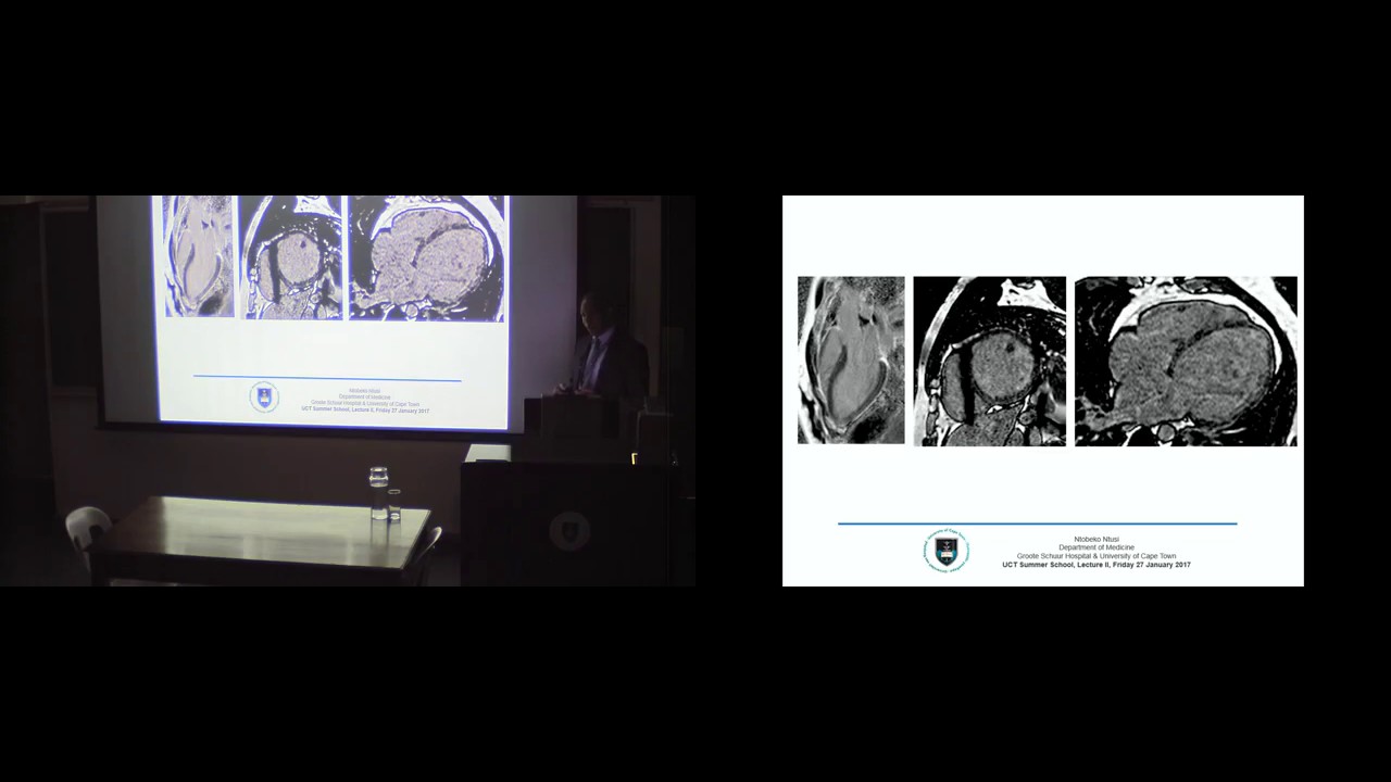 Ntobeko Ntusi Cardiovascular imaging 2: Cardiovascular magnetic ...