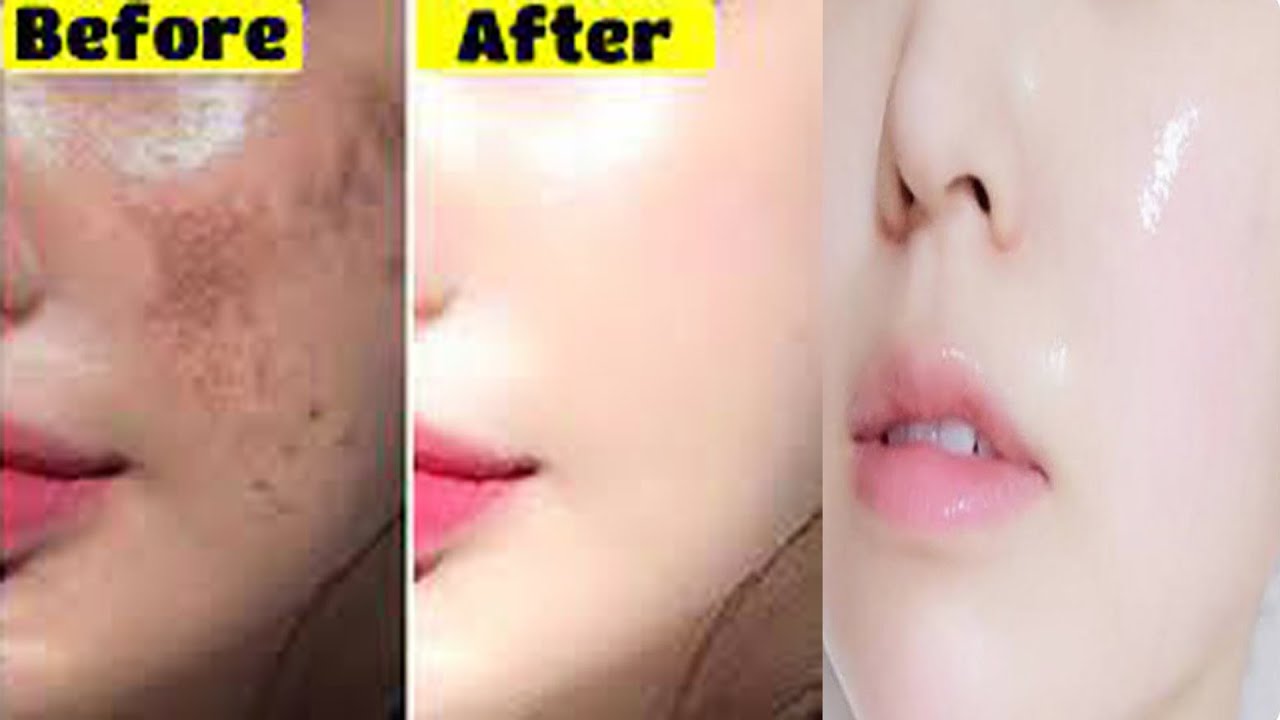Skin Tone, Whiten & Lighten Naturally | ងាយណាស់មុខស | Anti-Aging Secret ...