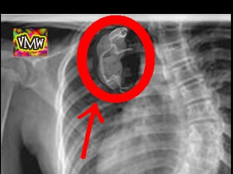 44 Strange objects found in an X-Ray - YouTube