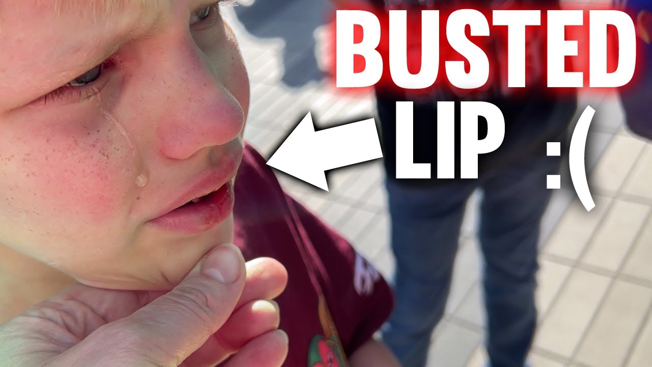 Michael Busted His Lip 😥 - YouTube