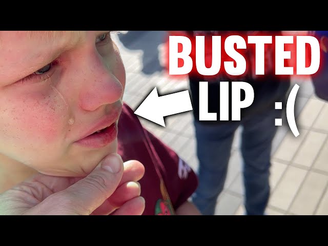 Michael Busted His Lip - Videos For Kids