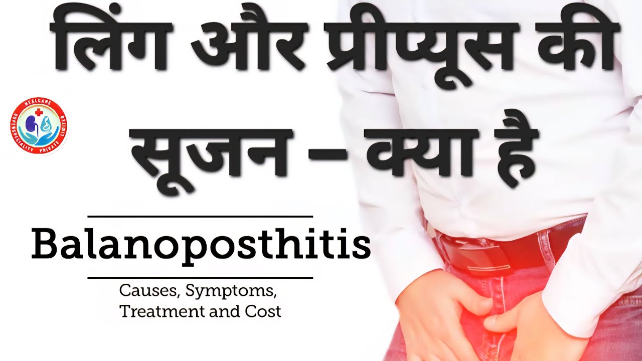 Balanoposthitis क्या है? लिंग और मुड़िका की सूजन की पूरी जानकारी, कारण ...