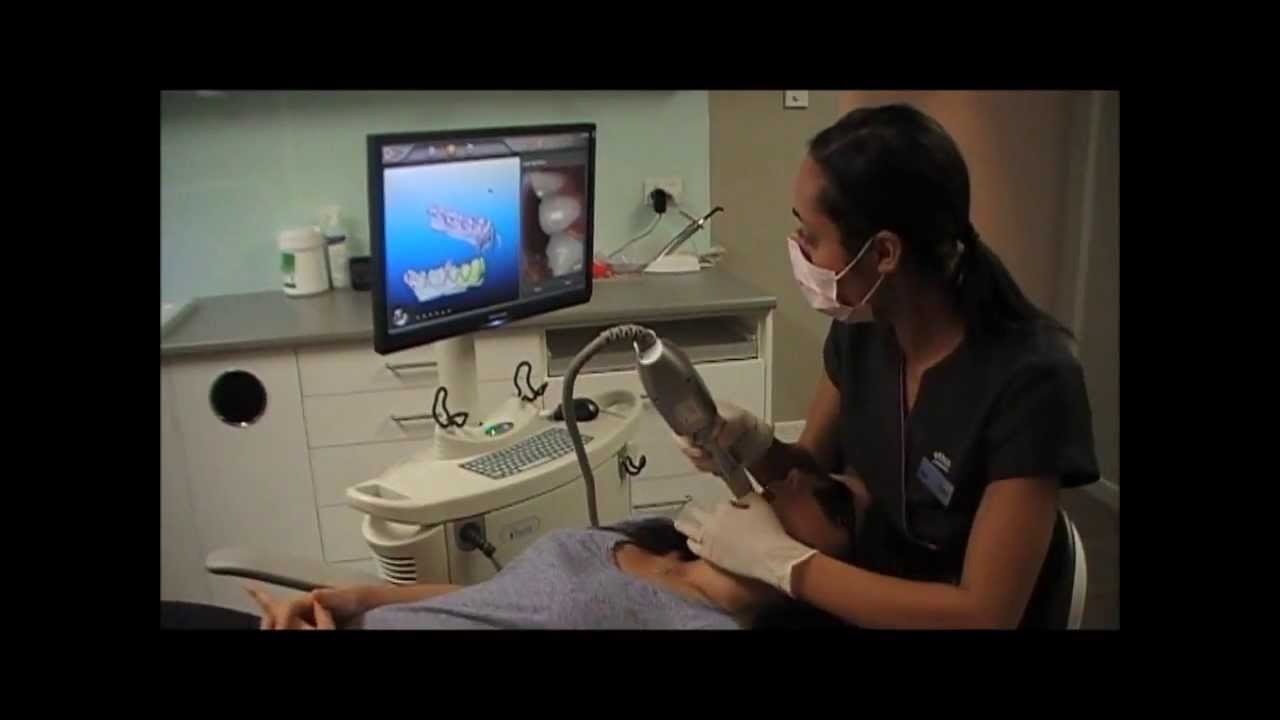 iTero Invisalign Scanner - YouTube