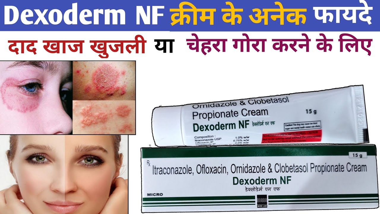 Dexoderm nf cream | dexoderm nf cream ke fayde | panderm plus cream ...