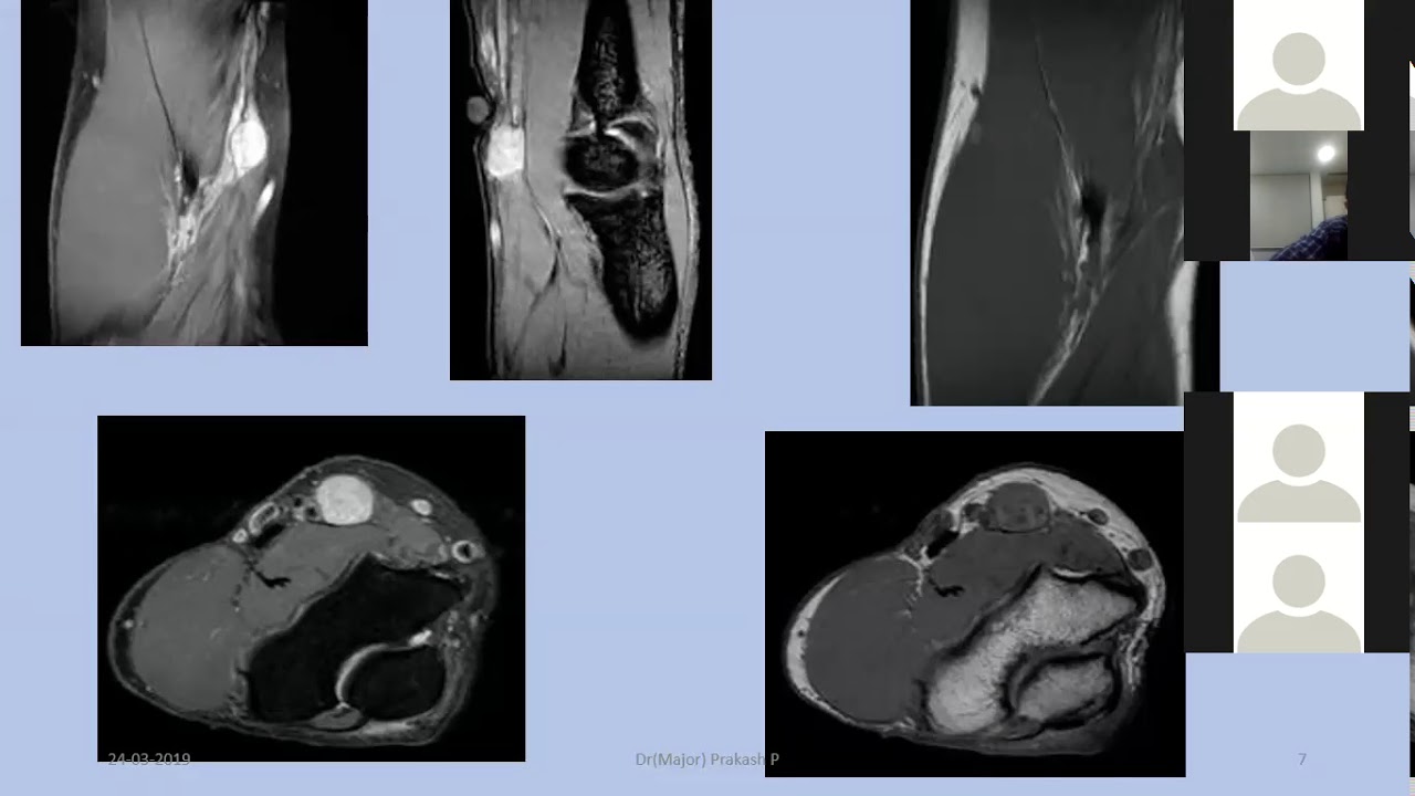 MSK CASE DISCUSSION for exams: EXAM ORIENTED APPROACH for ...