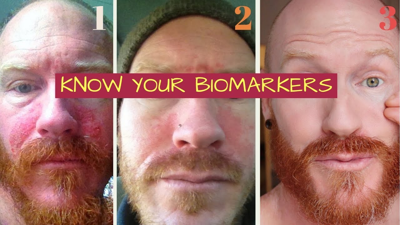 How to KNOW if you are on the right track HEALING YOUR SKIN - YouTube