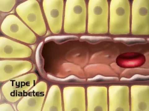 Pancreas - YouTube