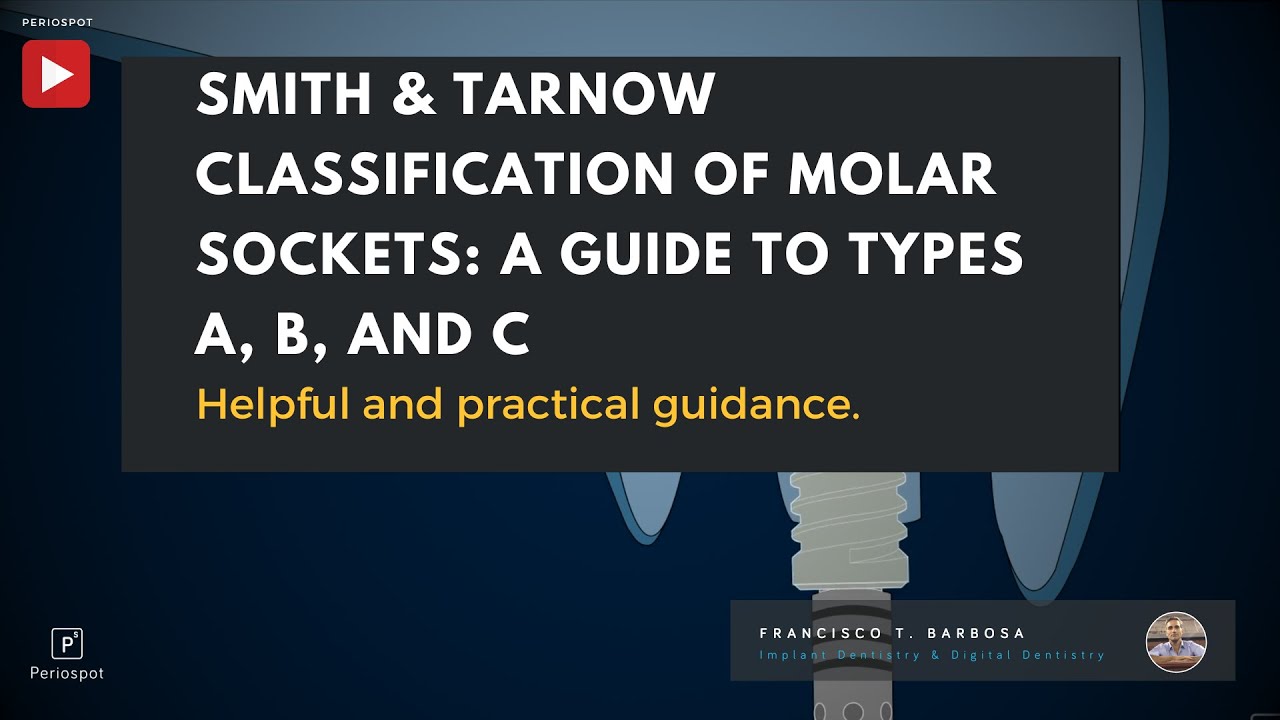 Smith & Tarnow Classification of Molar Sockets: A Guide to Types A, B ...