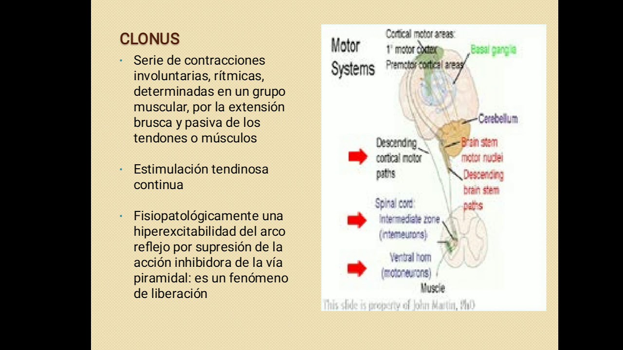 Reflejos, Clonus y Sincinecias. Continuación II. - YouTube