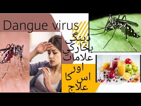 dengue fever symptoms and treatment at home\ ڈینگی بخار کی علامت اور ...