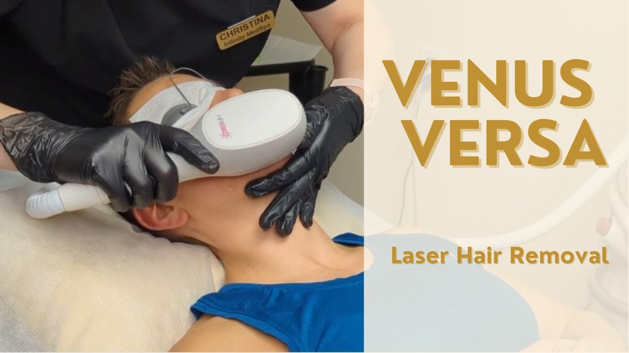 Laser Hair Removal Treatment with Venus Versa | Infinity MedSpa - YouTube