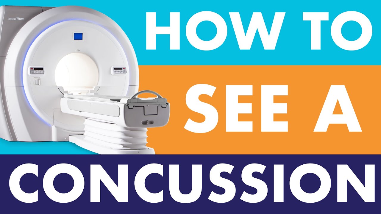 How to detect a concussion with an fMRI | Cognitive FX - YouTube