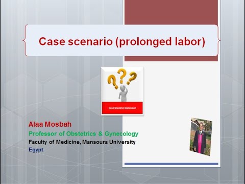 Case scenario (prolonged labor) - YouTube