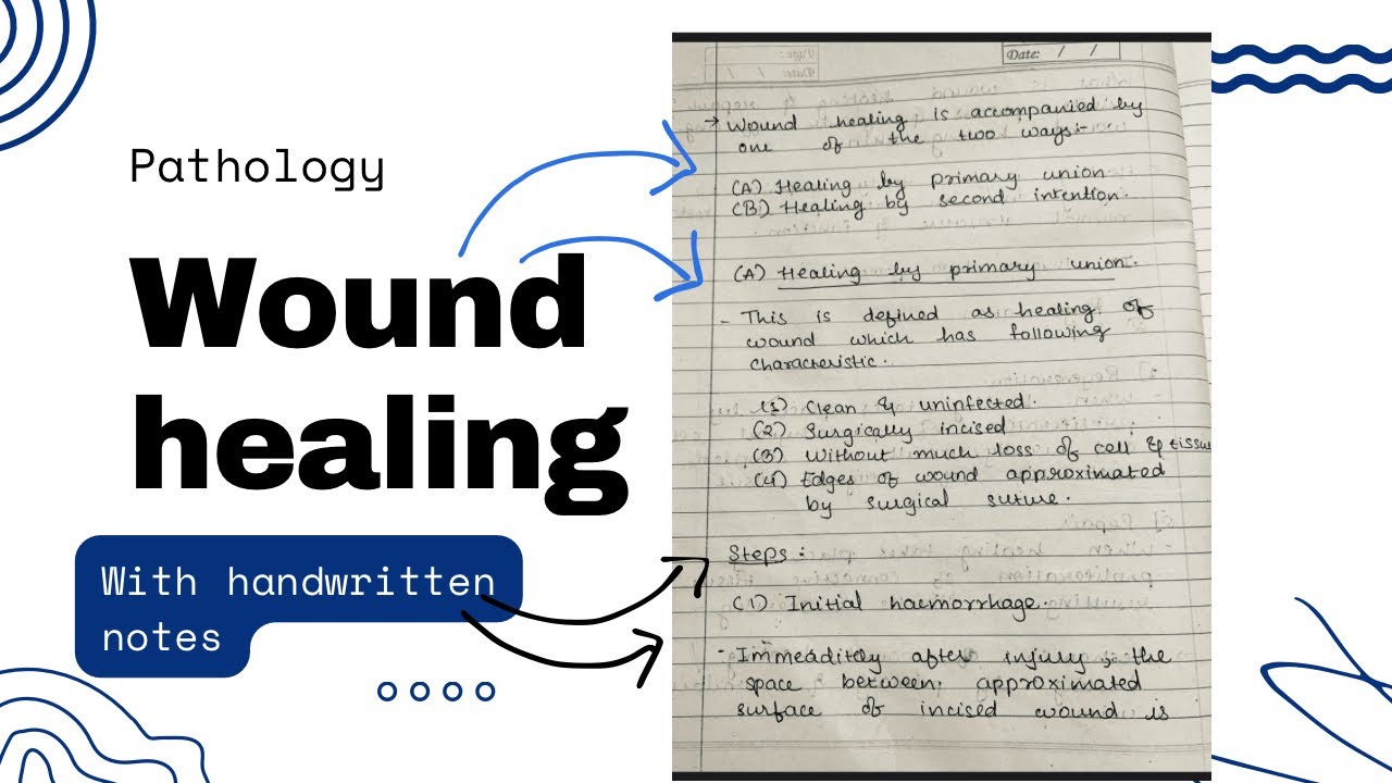 WOUND HEALING AND REPAIR || HARSH MOHAN PATHOLOGY || EASY EXPLANATION🔥🔥 - YouTube