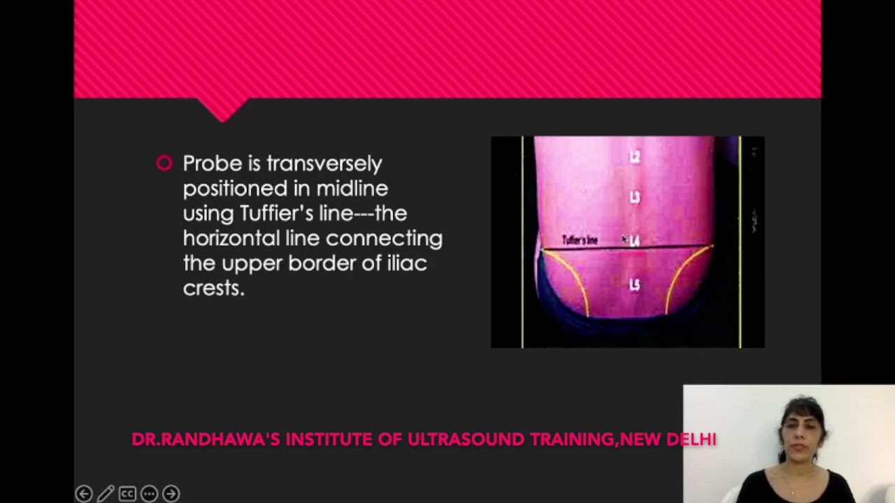 Ultrasound assisted lumbar puncture - YouTube
