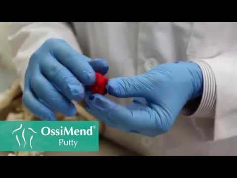 Collagen Matrix - Orthopaedic OssiMend® Putty - Product Demo - YouTube