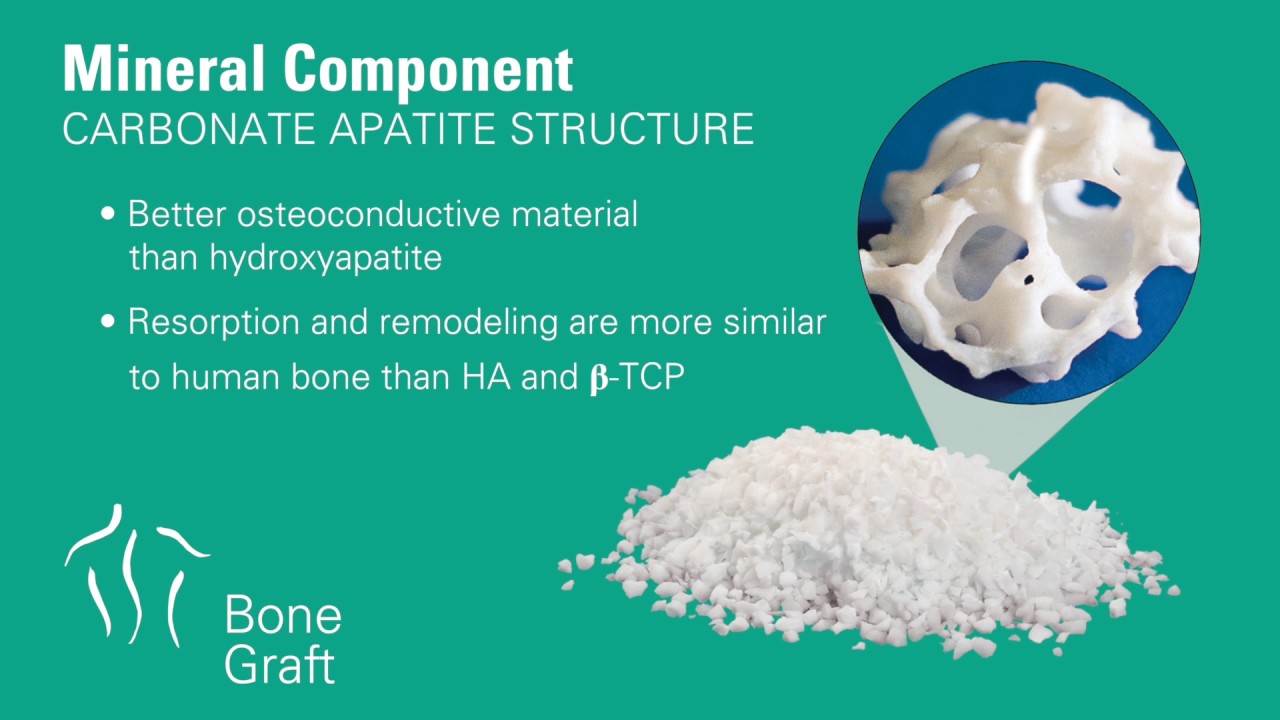 Collagen Matrix - Orthopaedic OssiMend® Putty - Product Demo - YouTube