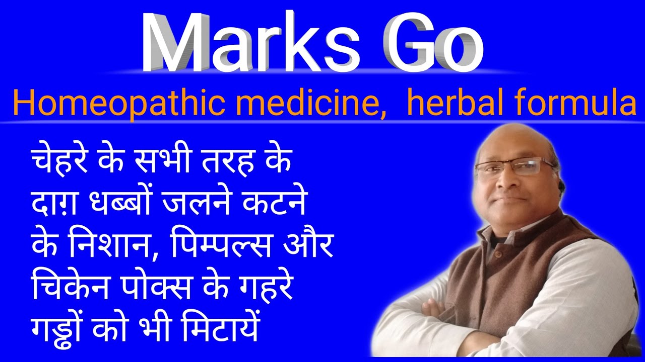 How To Remove Marks From Face Homeopathic Cream Marks Go YouTube how-to-remove-marks-from-face-homeopathic-cream-marks-go-youtube