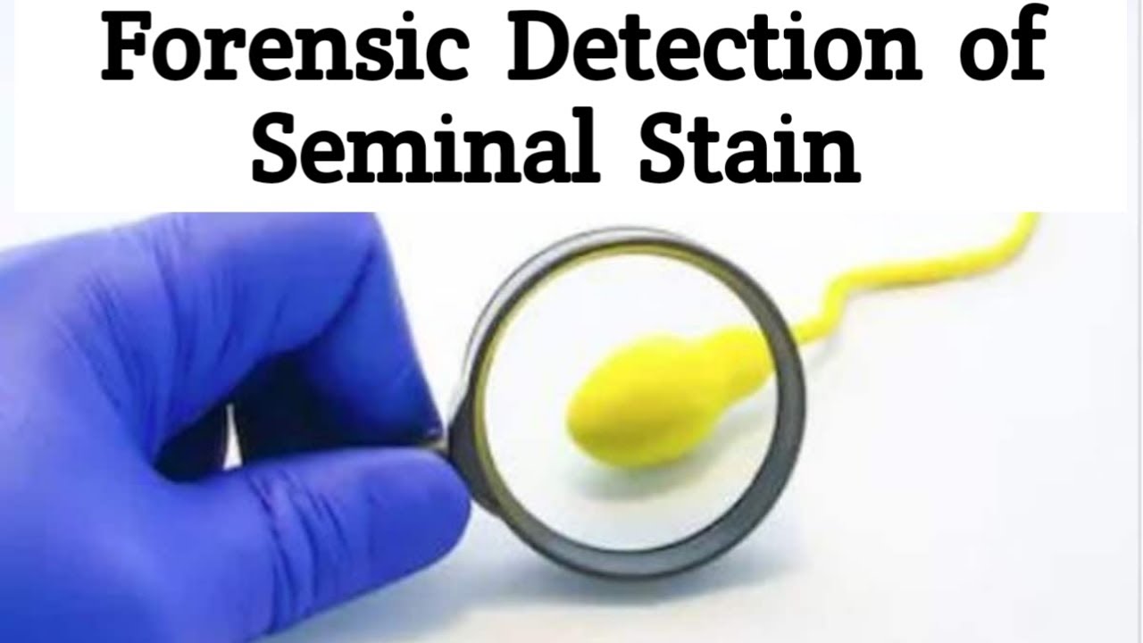 Forensic Detection of Seminal Stains|Different methods of Semen ...