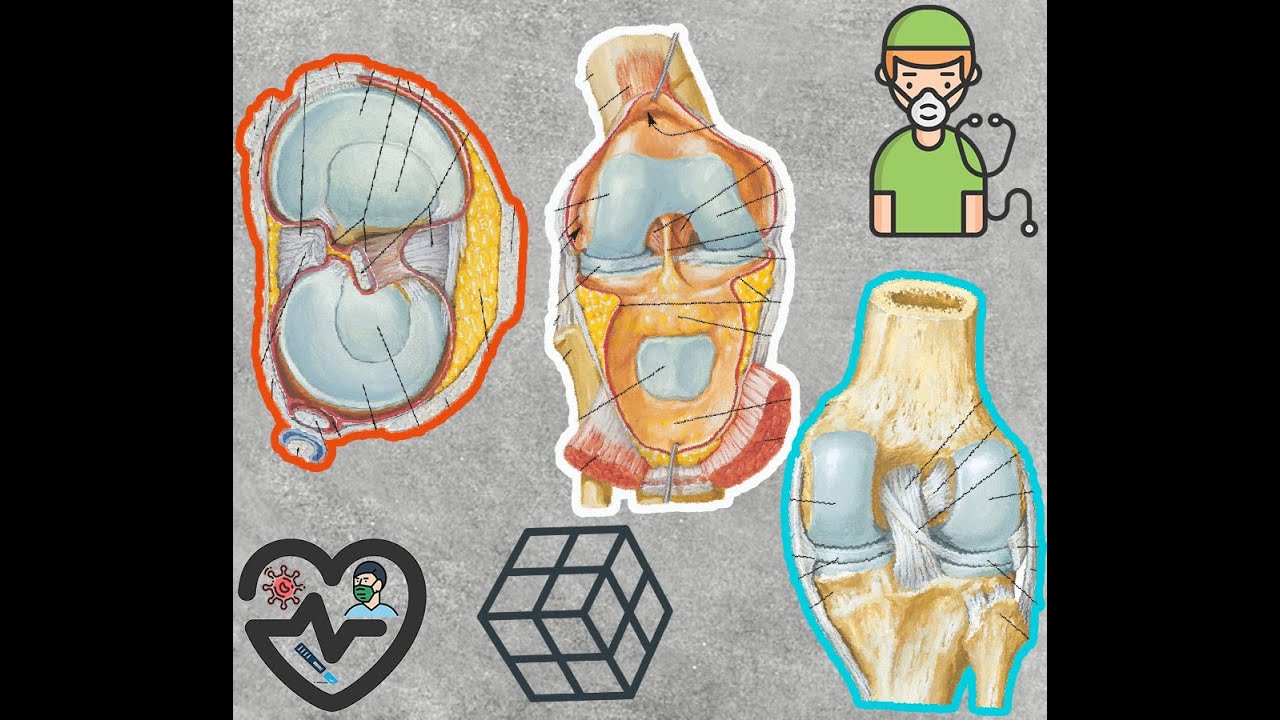 Arthroscopic total meniscectomy |what is meniscectomy? |knee MRI ...