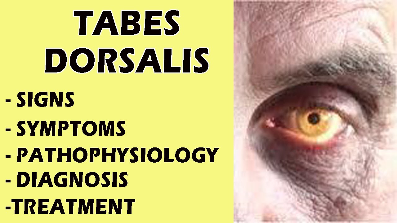 Tabes Dorsalis || Neurosyphilis Tabes Dorsalis || Tabes Dorsalis Signs ...